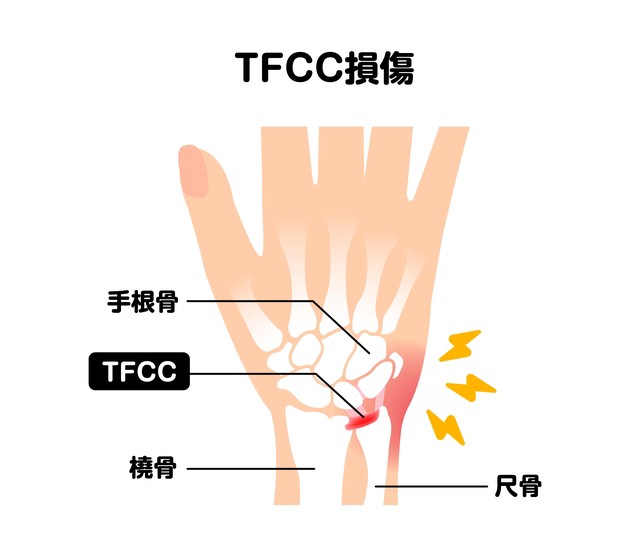 TFCC損傷について | リペアセルクリニック東京院